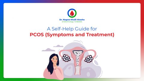 A Self-Help Guide for PCOS (Symptoms and Treatment)